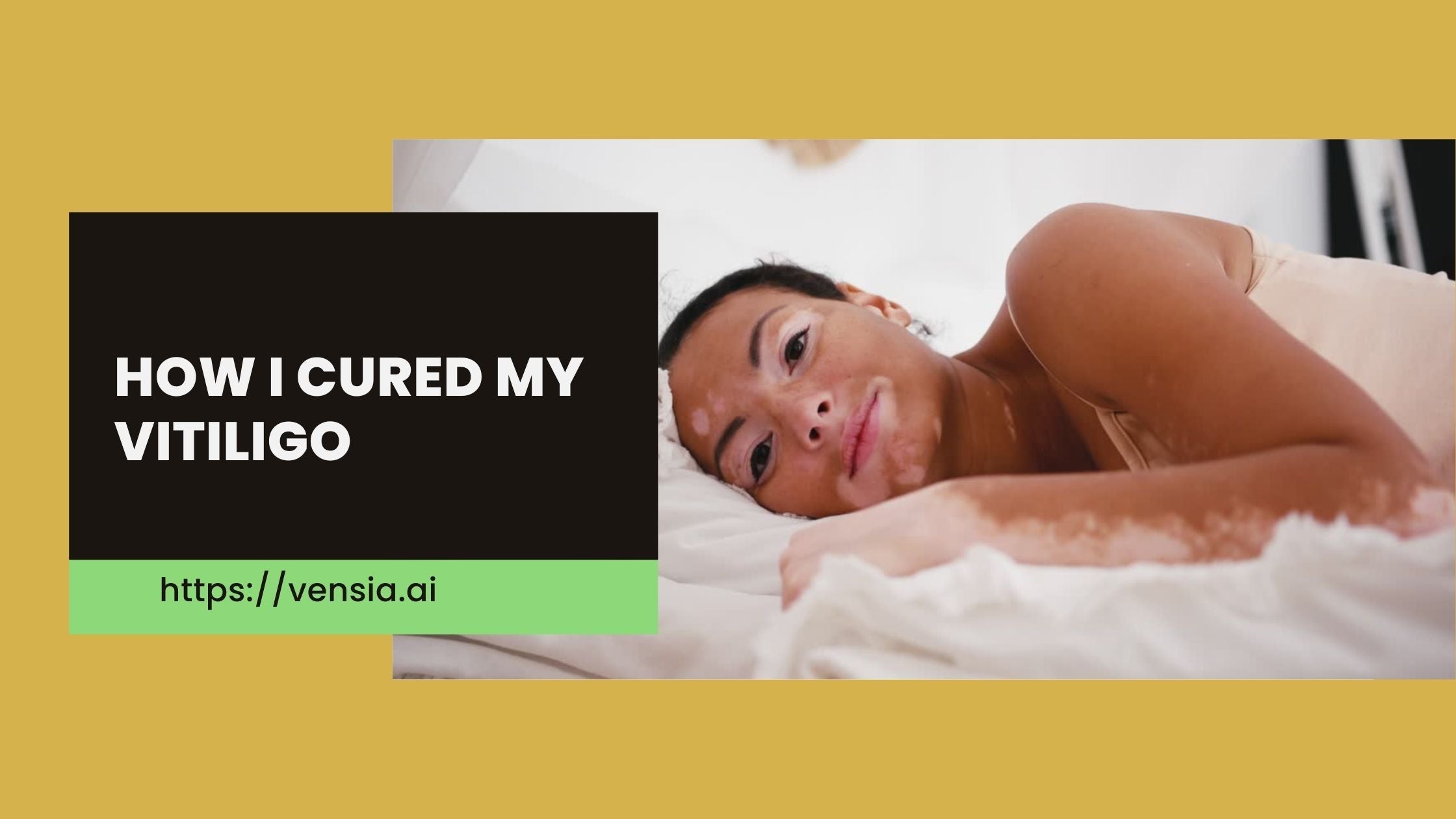 How I Cured My Vitiligo – A Real Journey to Clearer Skin | Vensia